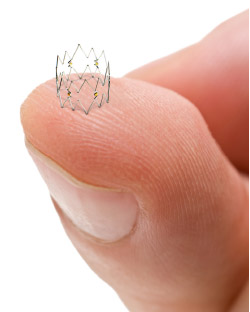 Tack endovascular system - Venous News