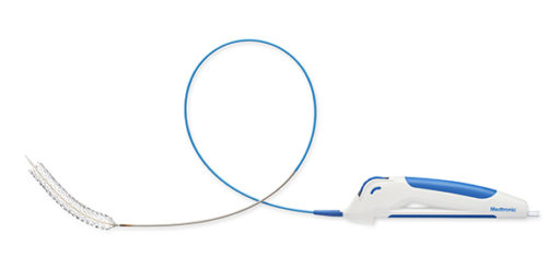 Medtronic launches IDE study of Abre venous stent