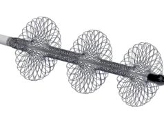 Prospective clinical data on the FlowTriever system confirms excellent ...