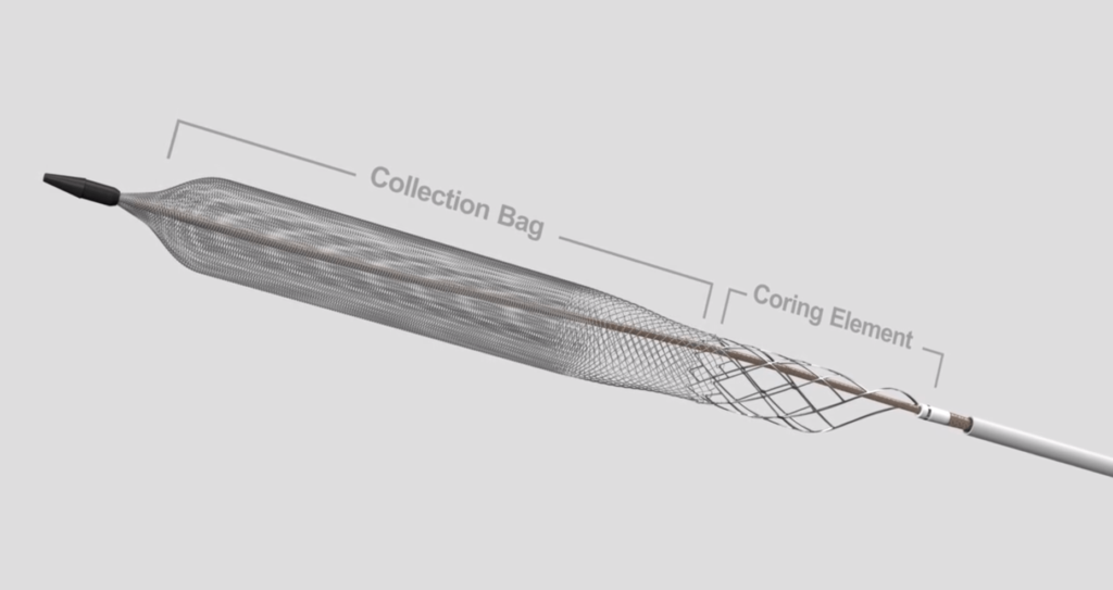 Inari Medical announces randomised controlled trial evaluating clinical ...