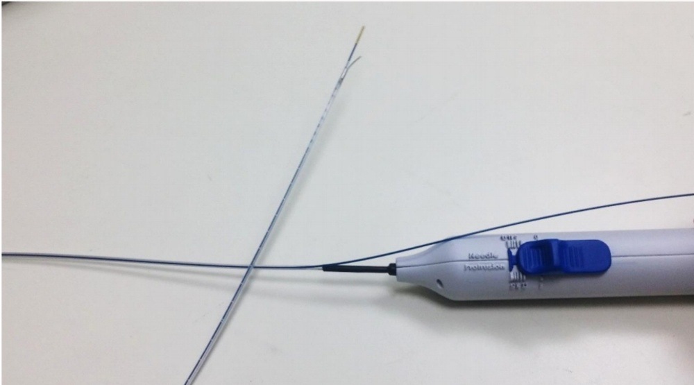 Intravenous anaesthesia delivery during varicose vein treatment proves ...