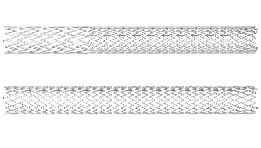 Philips launches Duo venous stent system for treatment of symptomatic ...