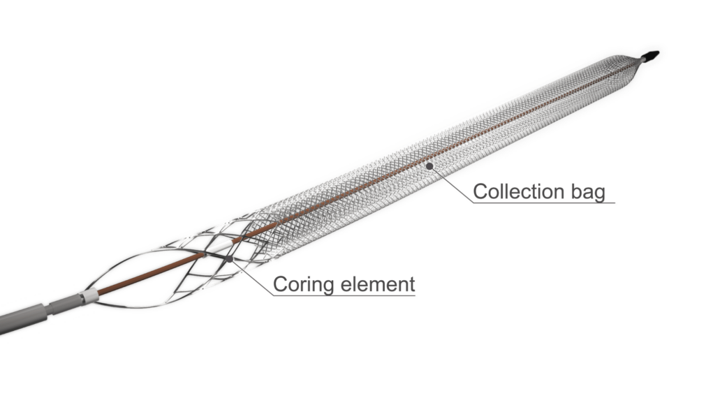 Inari Medical’s ClotTriever thrombectomy system gains reimbursement ...