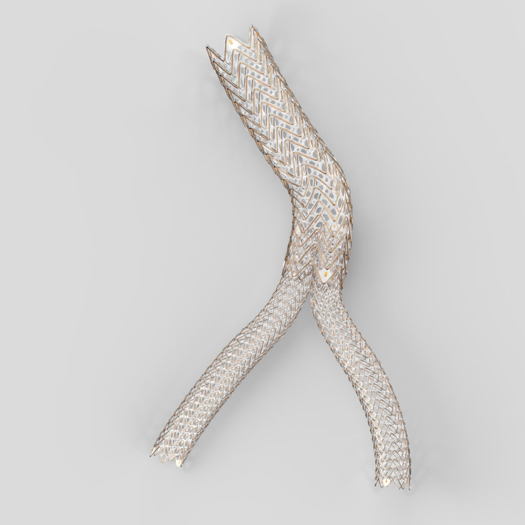 Gore announces US FDA approval for Fortegra venous stent - Venous News